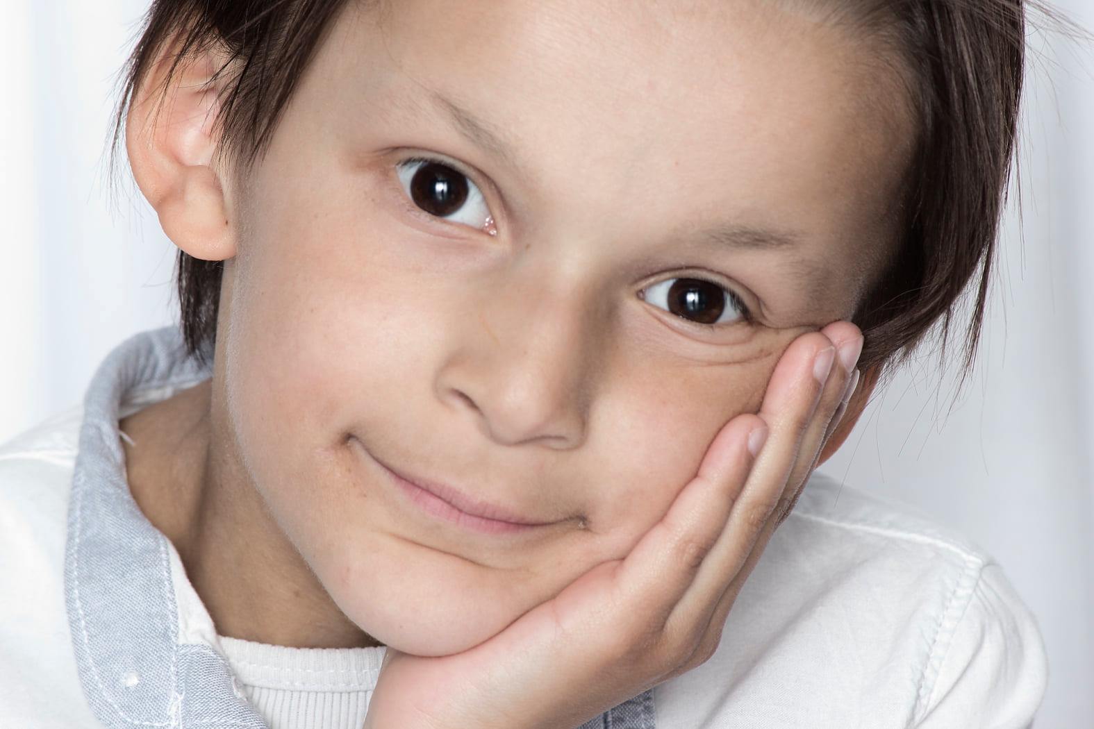 AFDE | Association Française Des Dysplasies Ectodermique